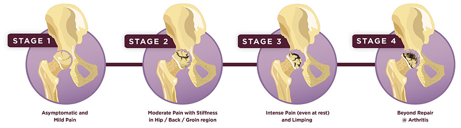 OSSGROW - For Patients